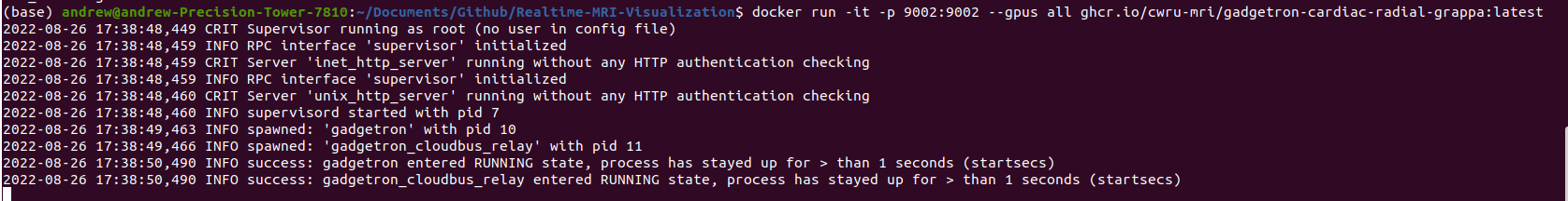 Getting Started: Realtime-MRI-Visualization – Case MRI