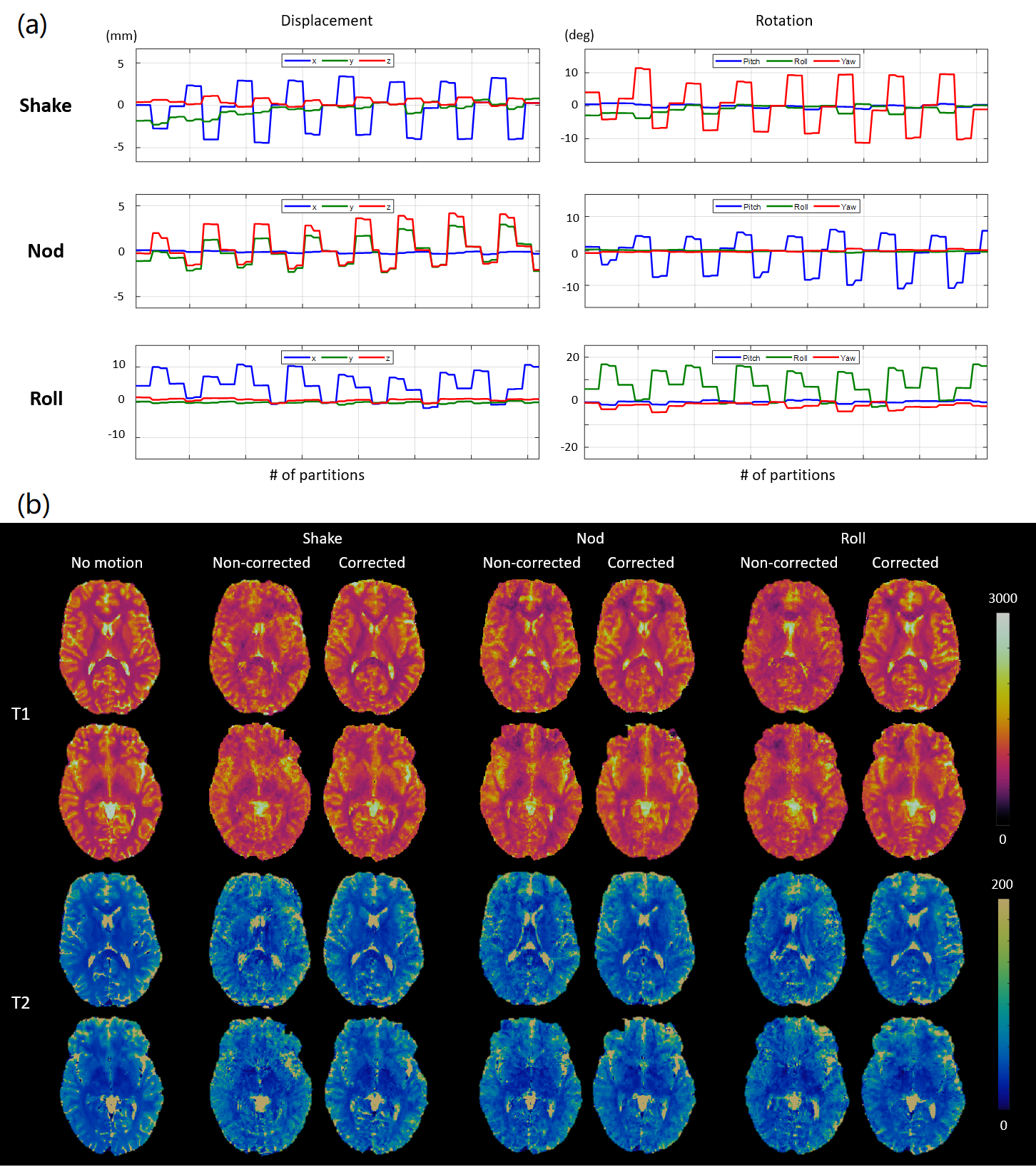 ISMRM 2023 Abstracts – Case MRI